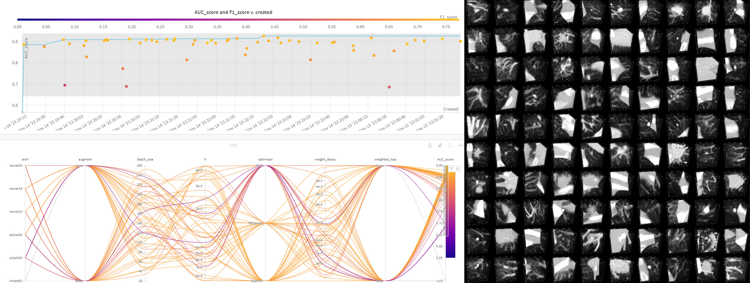 Ct Lung Nodule Classification Package Saied Salem